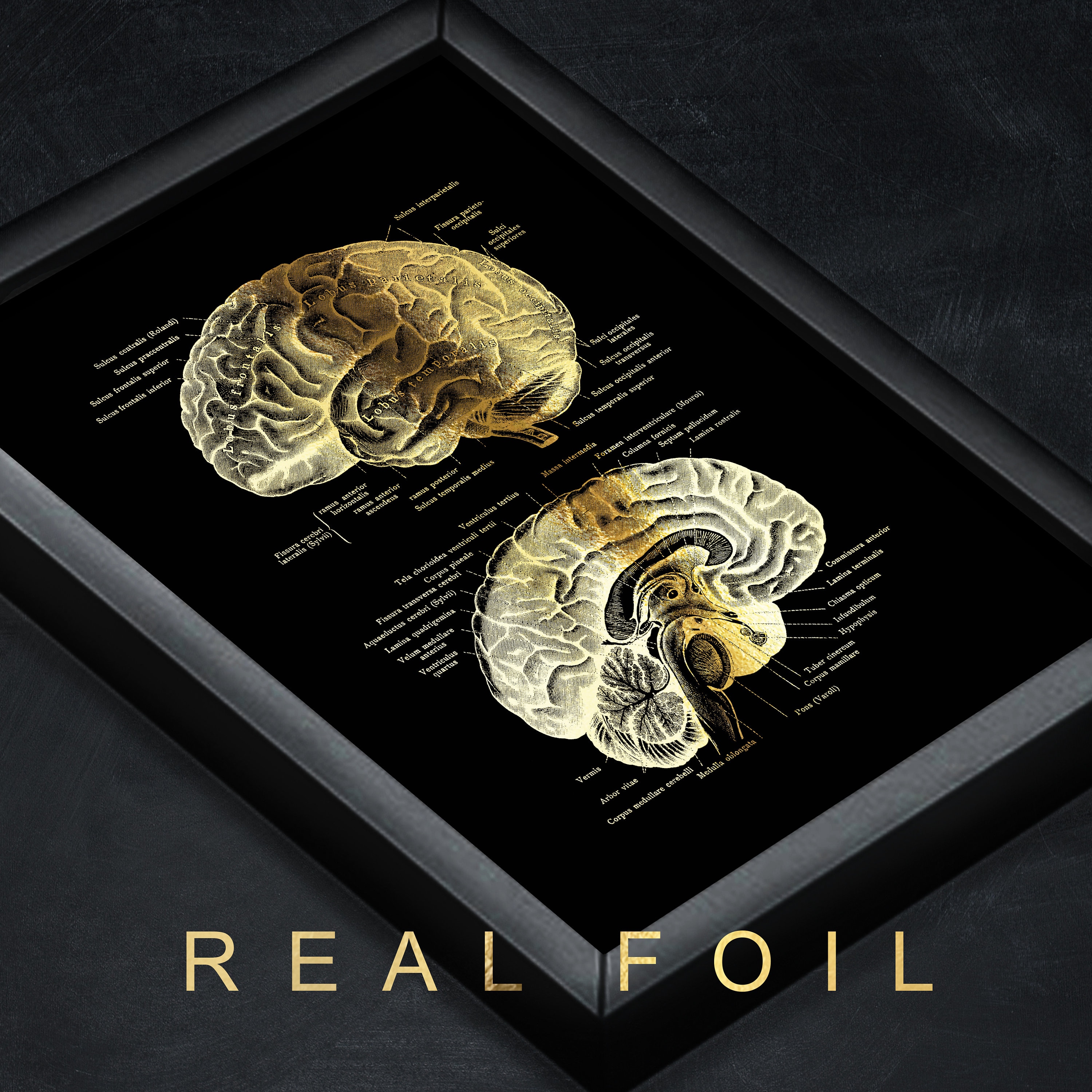 Gold Brain Anatomy Art Neurology Art Medical Art Neurologist Art ...