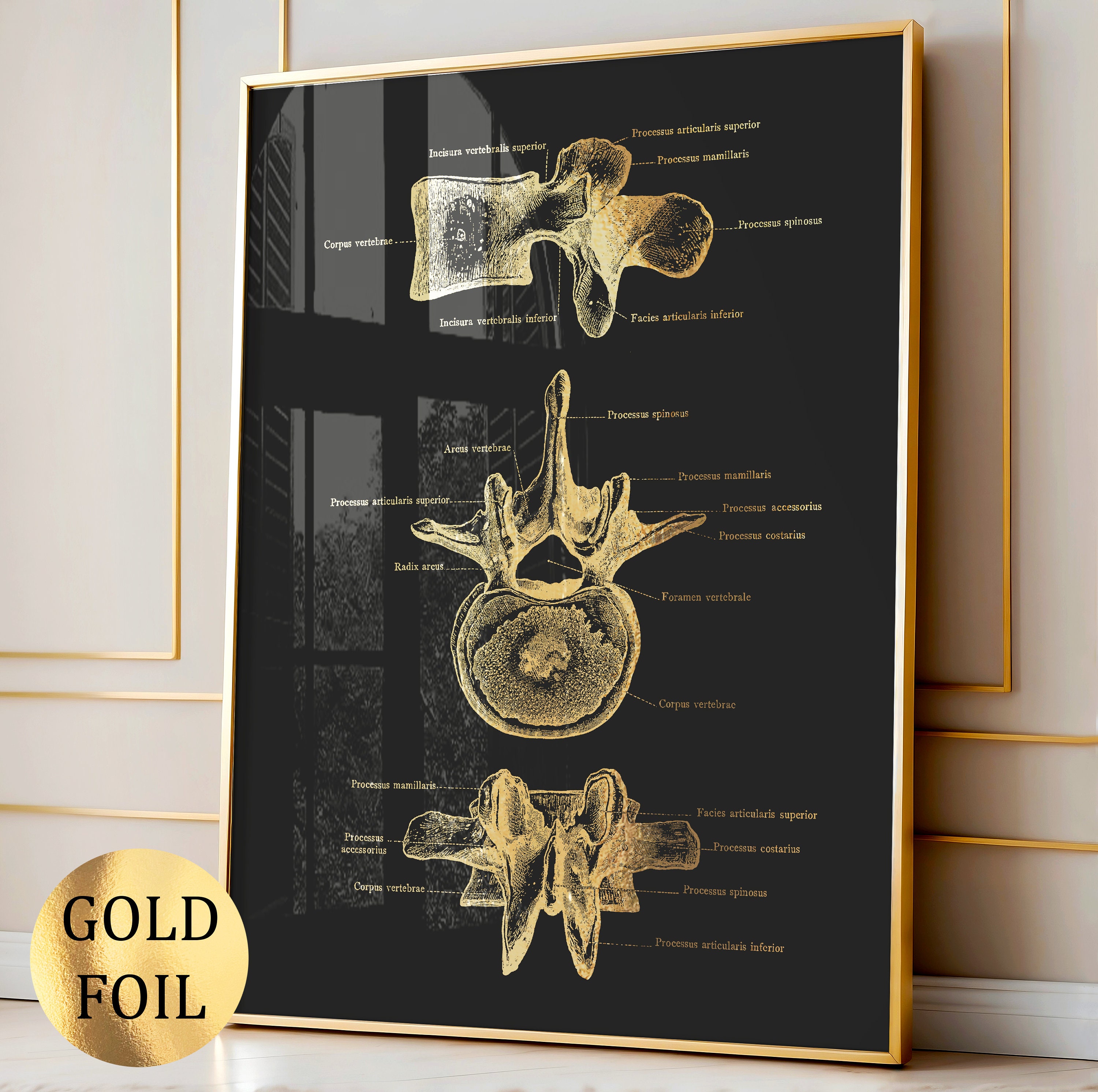 6 Spine Vertebral Column Anatomy Art Vertebrae Poster Spinal Diagram ...