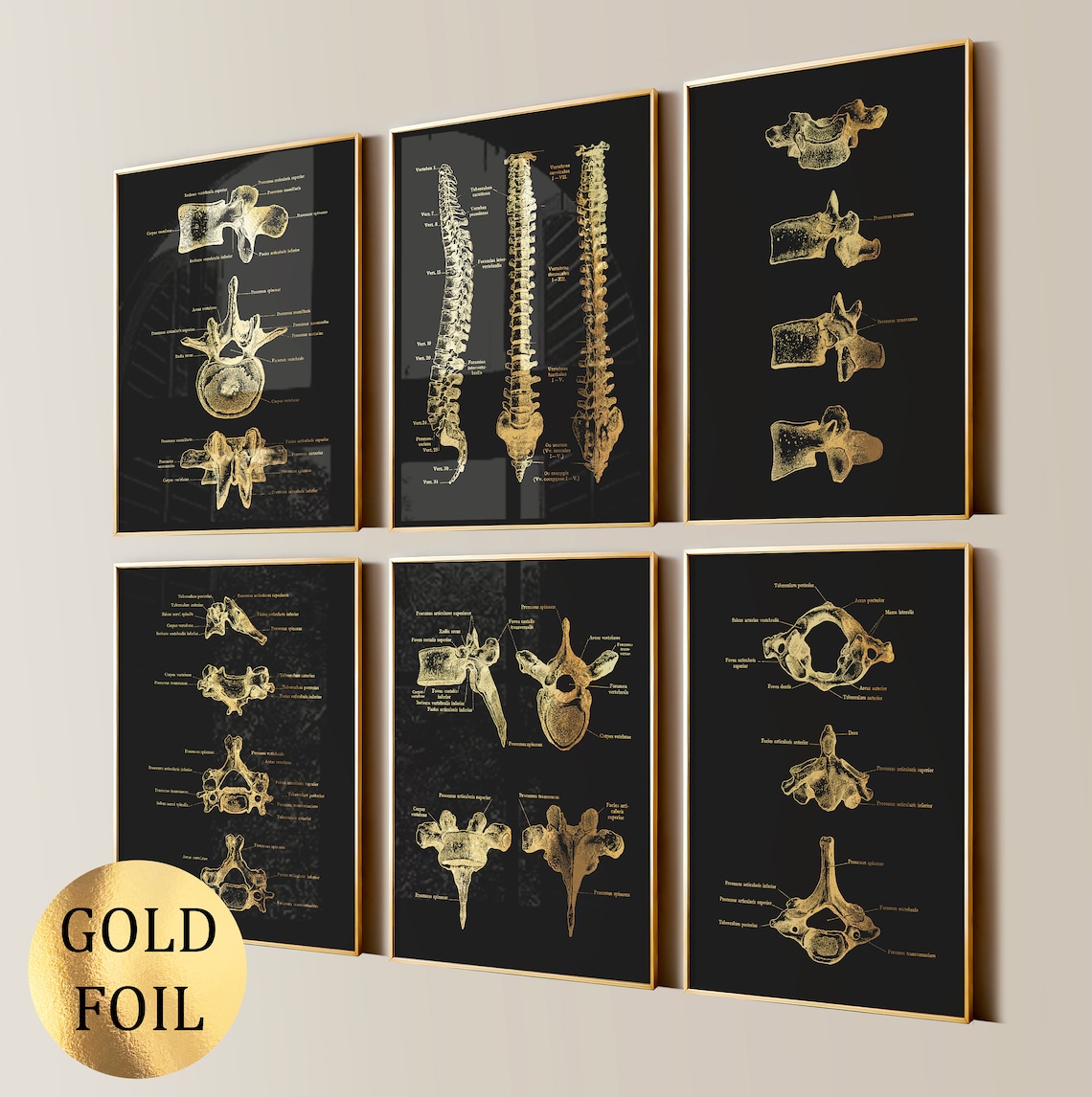 6 Spine Vertebral Column Anatomy Art Vertebrae Poster Spinal Diagram ...
