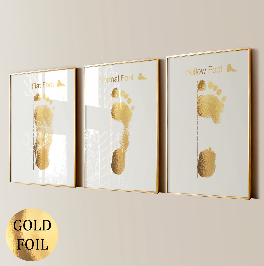 Set 3 Gold Footprint Types Posters Anatomy Art Foot Pathologies Foot ...