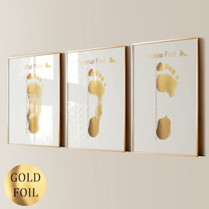 Set 3 Gold Footprint Types Posters Anatomy Art Foot Pathologies Foot ...