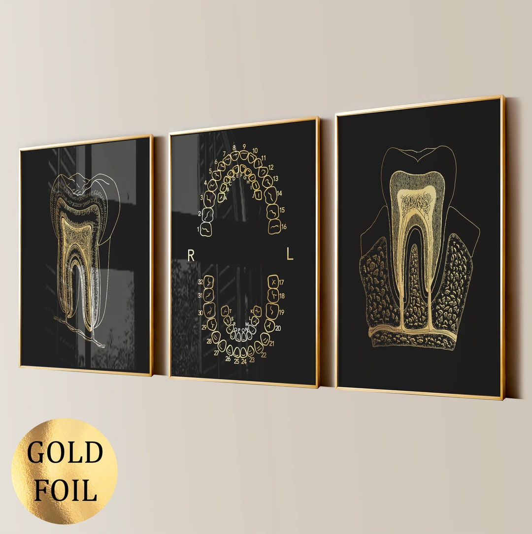 3 Tooth Anatomy Art Tooth Numbering Poster Dentistry Art Medical Art ...