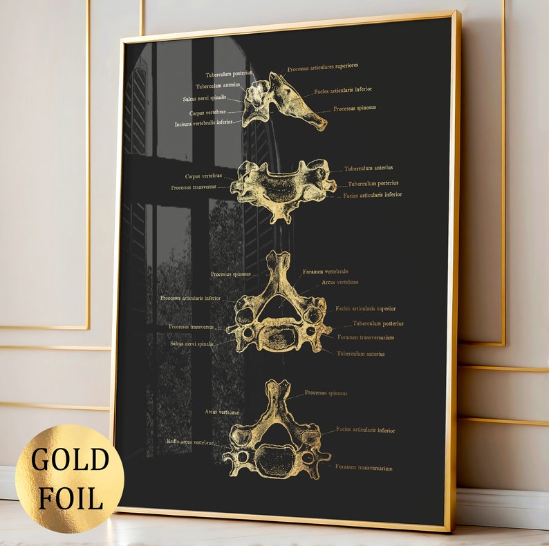 6 Spine Vertebral Column Anatomy Art Vertebrae Poster Spinal Diagram ...