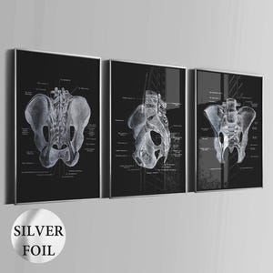 3 Pelvis Anatomy Posters Orthopedic Art Medical Art Obgyn Art Pelvic ...