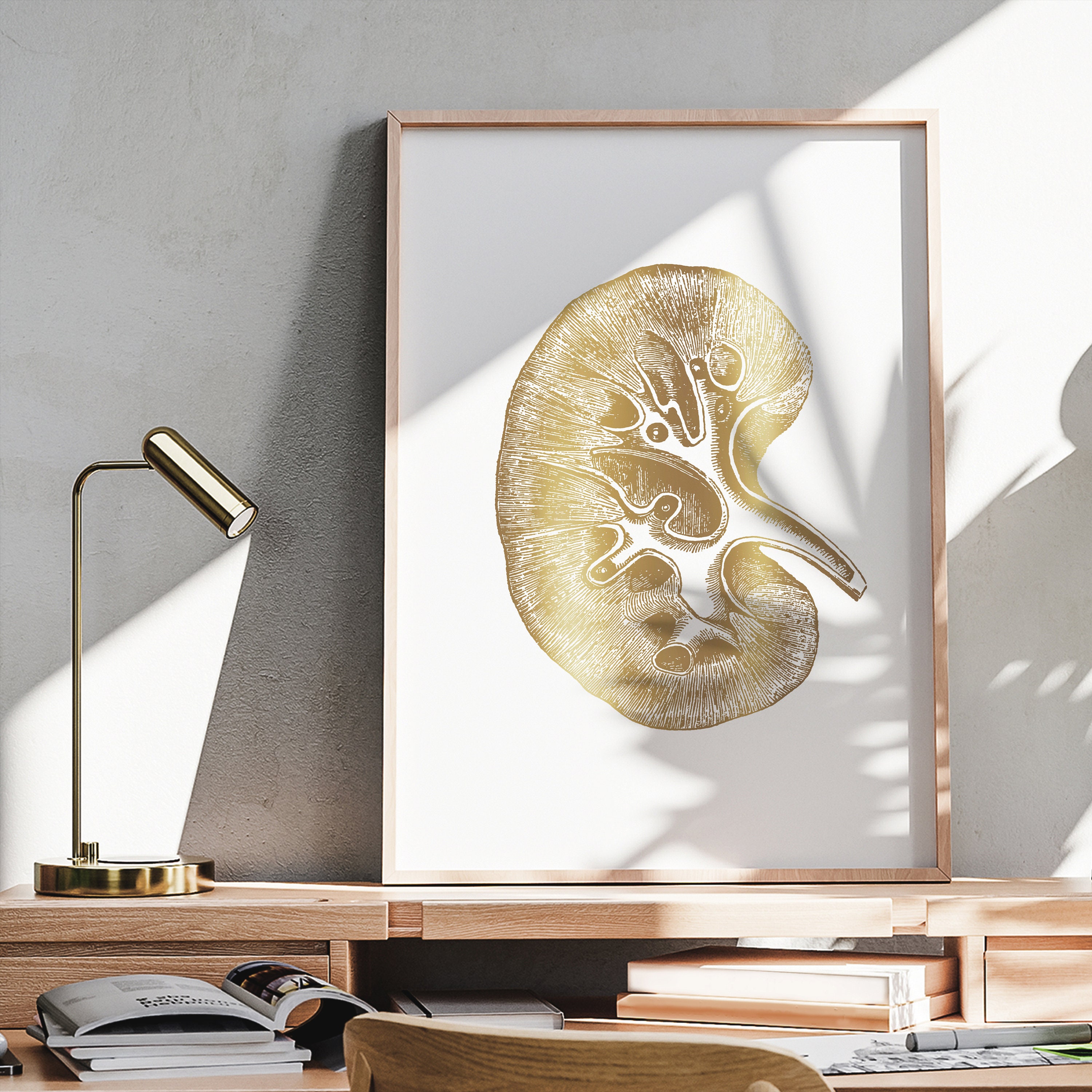 Kidney Anatomy Art Gold Foil Medical Art Nephrologist Office Gift ...