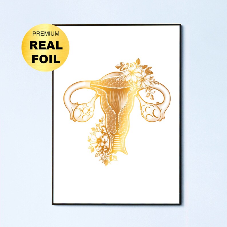 Uterus Art Gold Anatomy Art Medical Art Reproductive System Poster ...