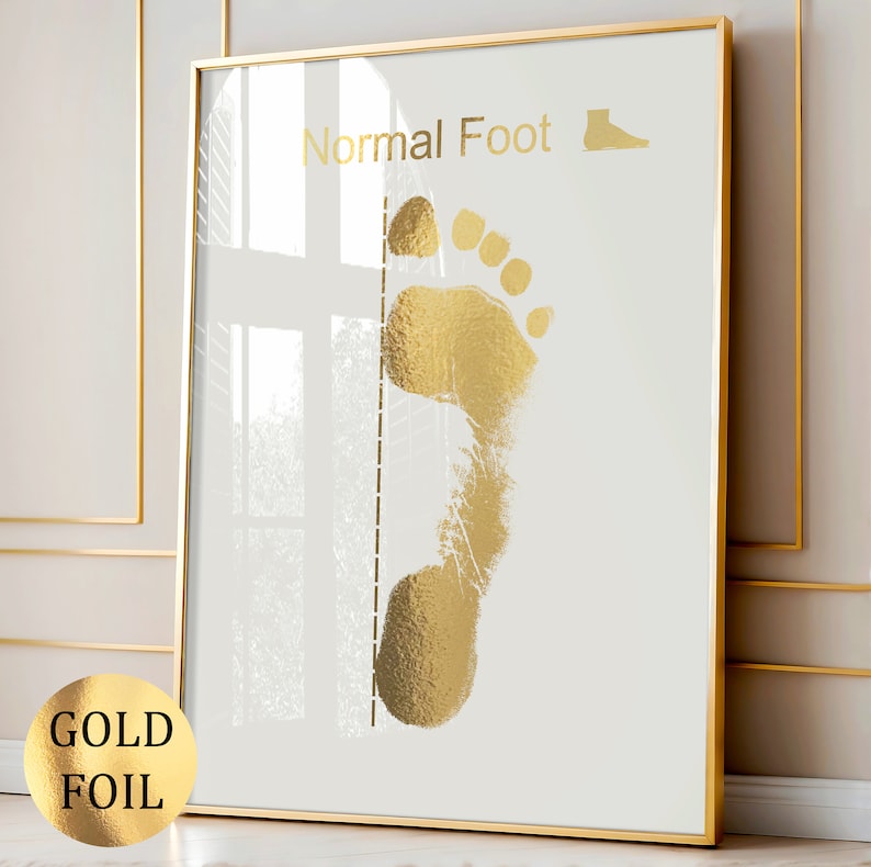 Set 3 Gold Footprint Types Posters Anatomy Art Foot Pathologies Foot ...