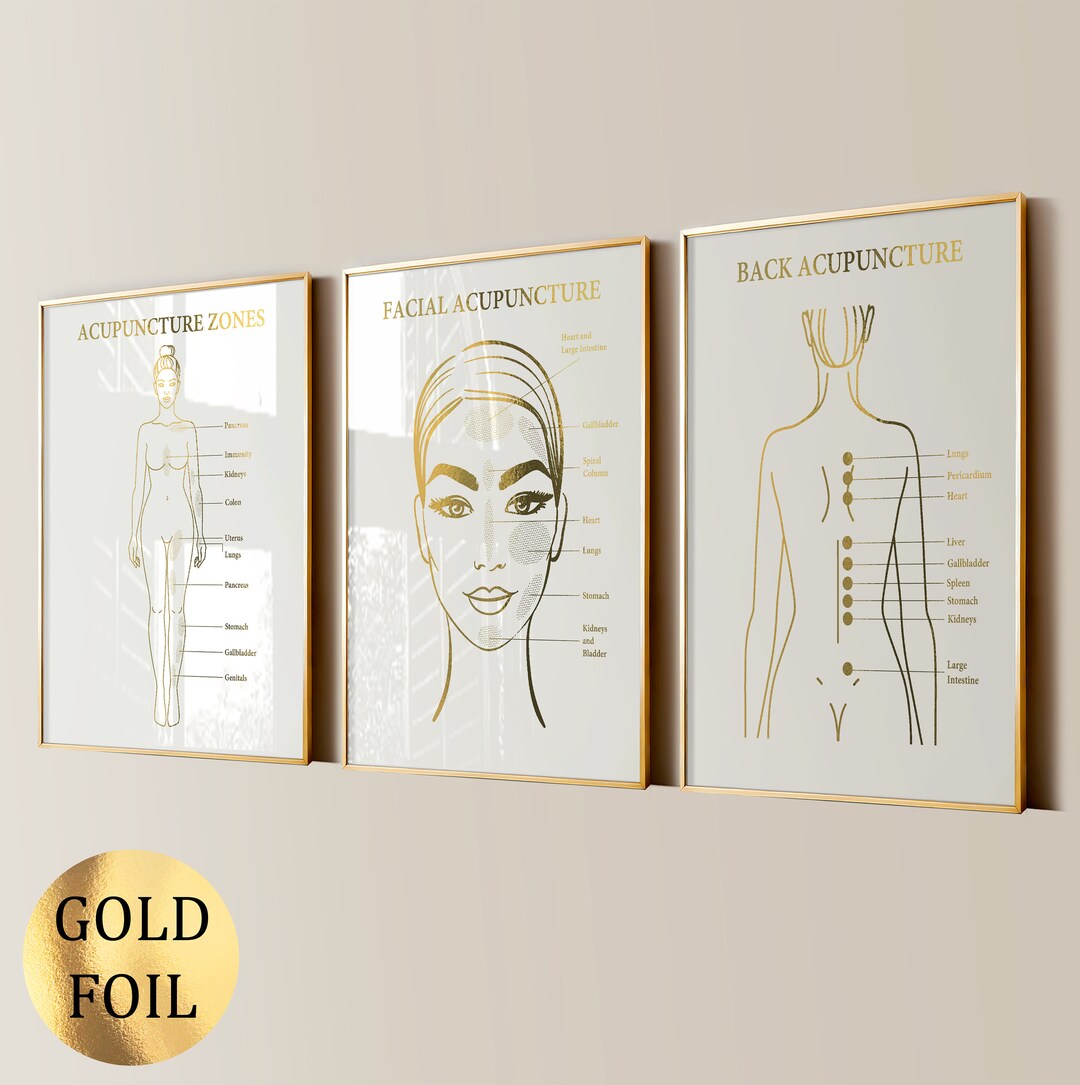 3 Acupuncture Therapy Posters Reflexology Art Alternative Medicine Art ...