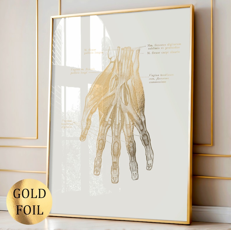 Set 6 Hand Anatomy Art Orthopedic Poster Medical Art Hand Diagram Wrist ...
