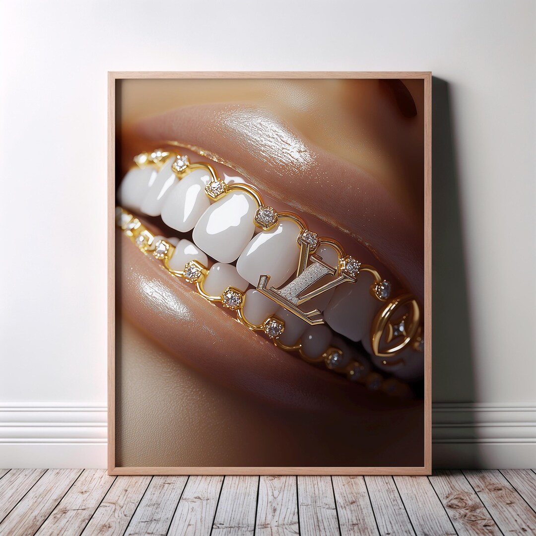 Woman With Glossy Lips and Grillz Wall Art, Gold Grillz, Woman Wall Art ...