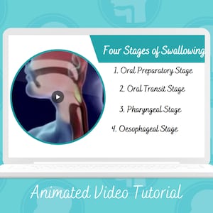 Adult Speech Therapy DYSPHAGIA COURSE (stages of Swallowing) Speech ...