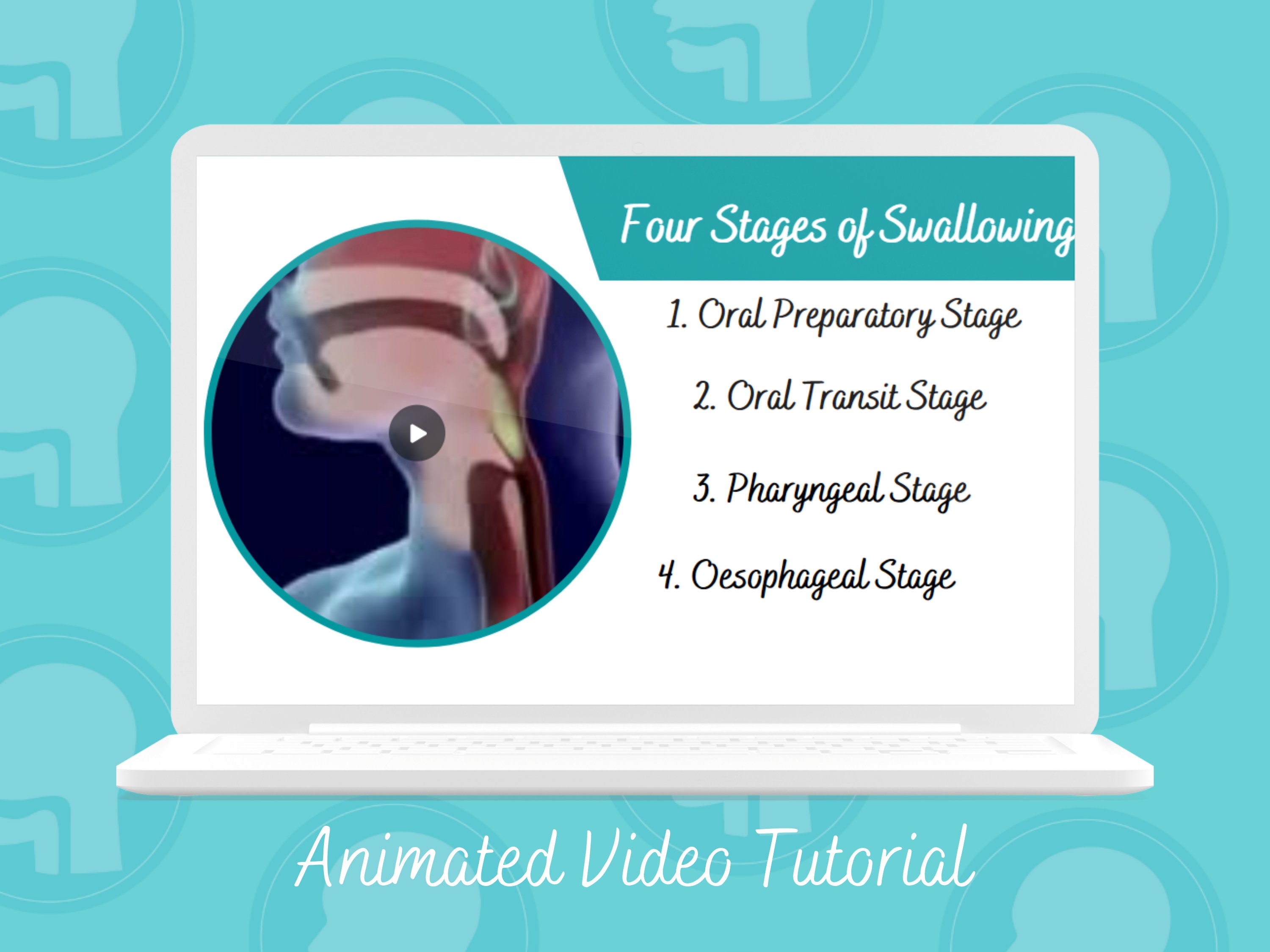 Adult Speech Therapy DYSPHAGIA COURSE (stages of Swallowing) Speech ...