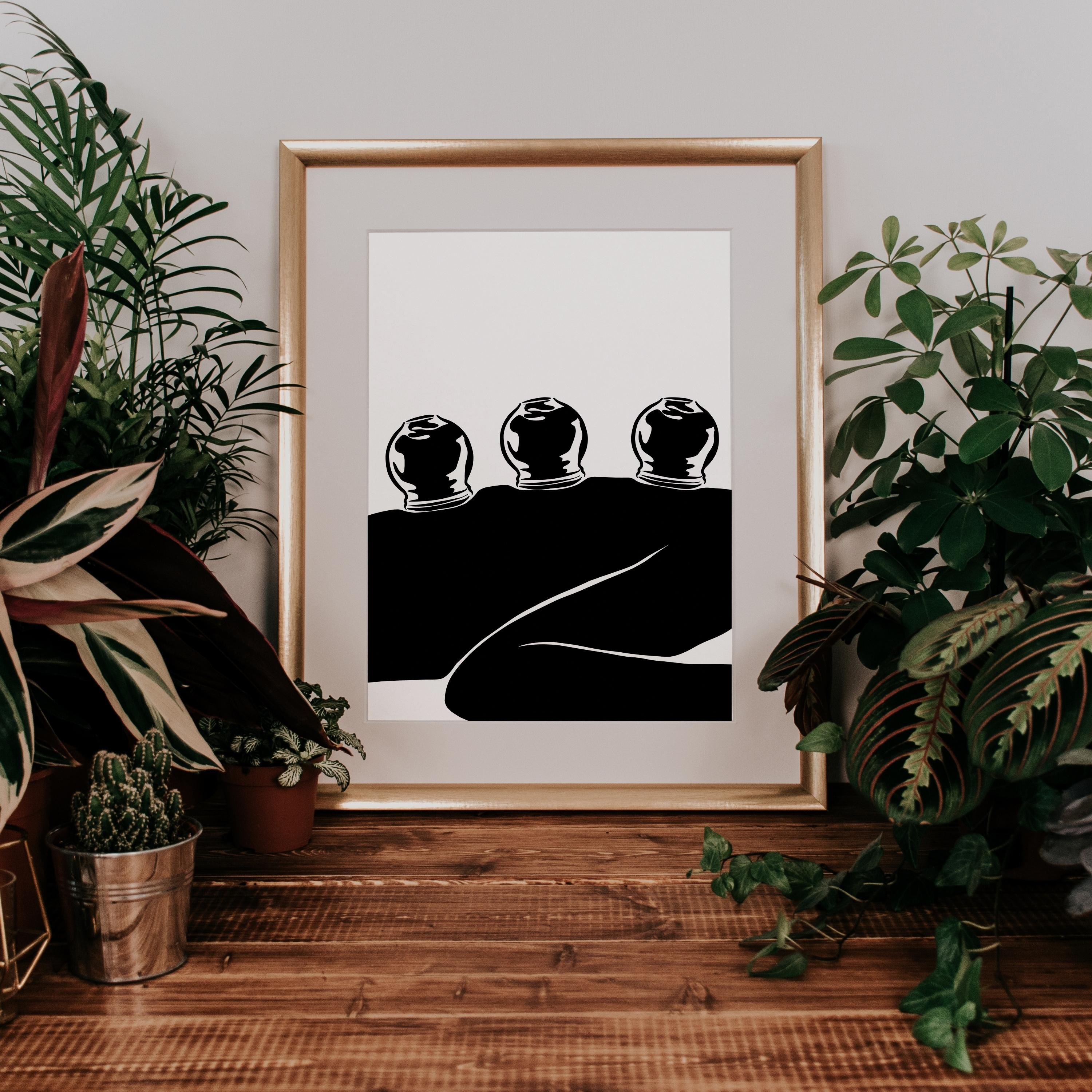 Cupping Massage Therapy Art Print Digital Acupuncture Poster ...