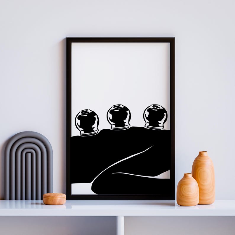 Cupping Massage Therapy Art Print Digital Acupuncture Poster ...