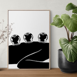 Cupping Massage Therapy Art Print Digital Acupuncture Poster ...