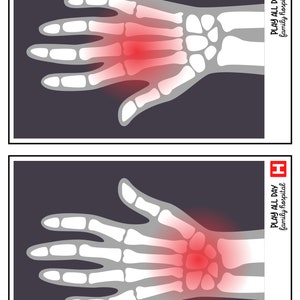 X-ray Pretend Play Printable Bundle for Kids (instant Download) - Etsy