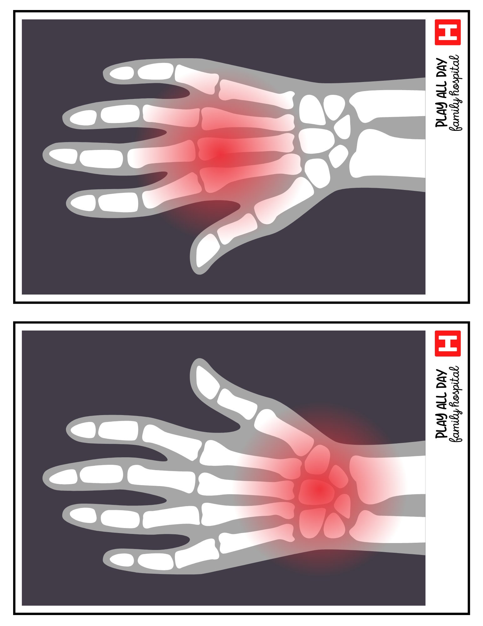 X-ray Pretend Play Printable Bundle for Kids (instant Download) - Etsy