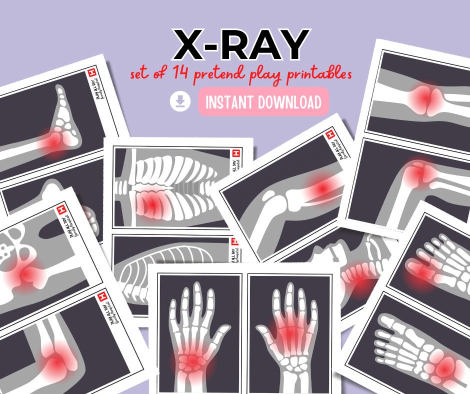 X-ray Pretend Play Printable Bundle for Kids (instant Download) - Etsy