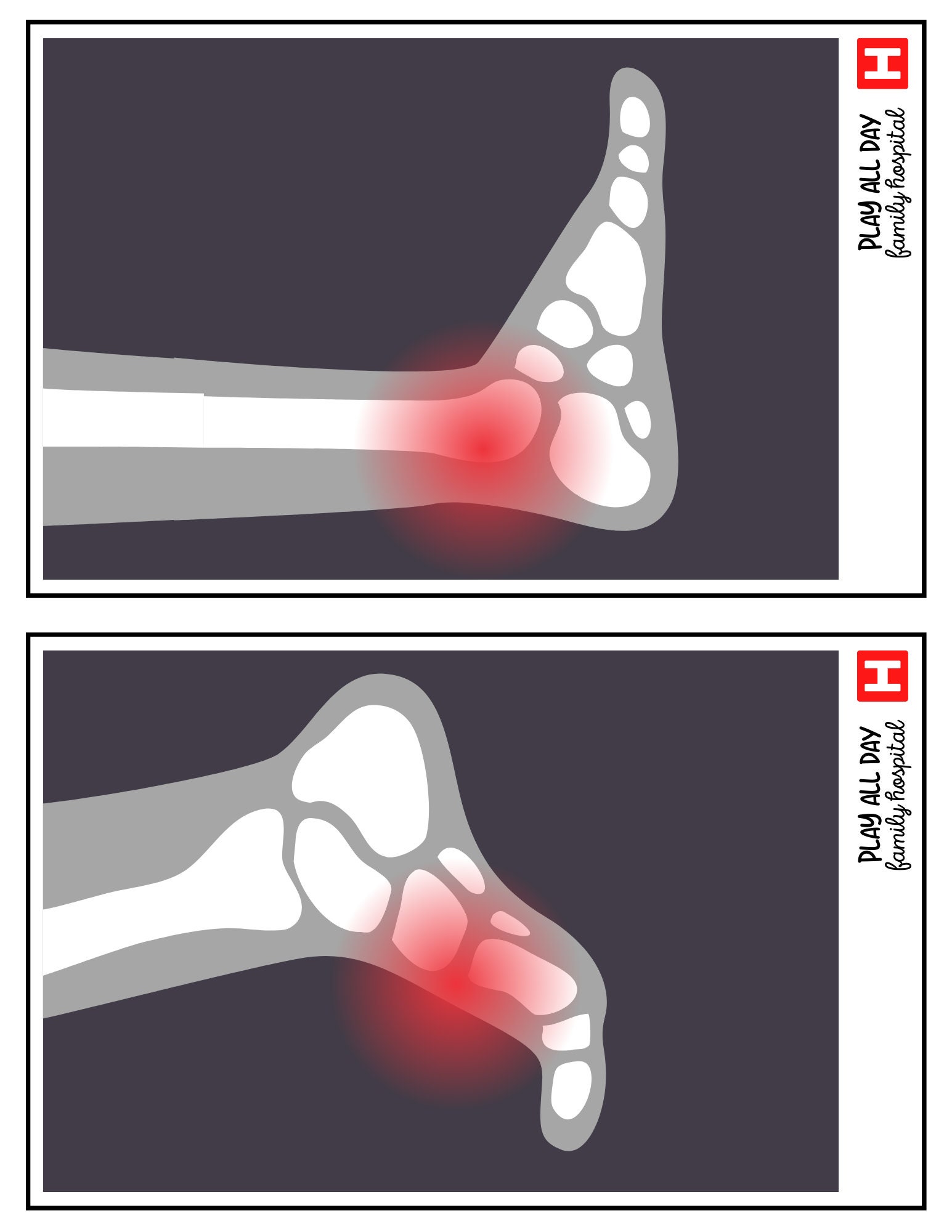 X-ray Pretend Play Printable Bundle for Kids (instant Download) - Etsy