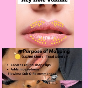 Hyaluron Pen Lip Maps, Lip Mapping Guides, Techniques, Russian Lips ...