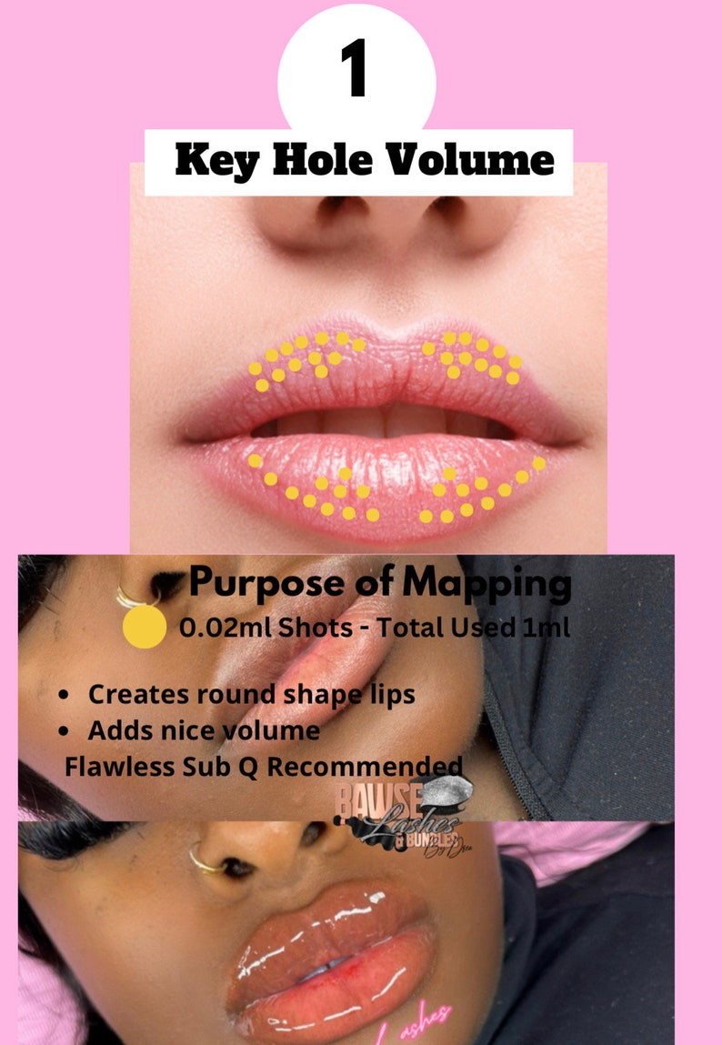 Hyaluron Pen Lip Maps, Lip Mapping Guides, Techniques, Russian Lips ...