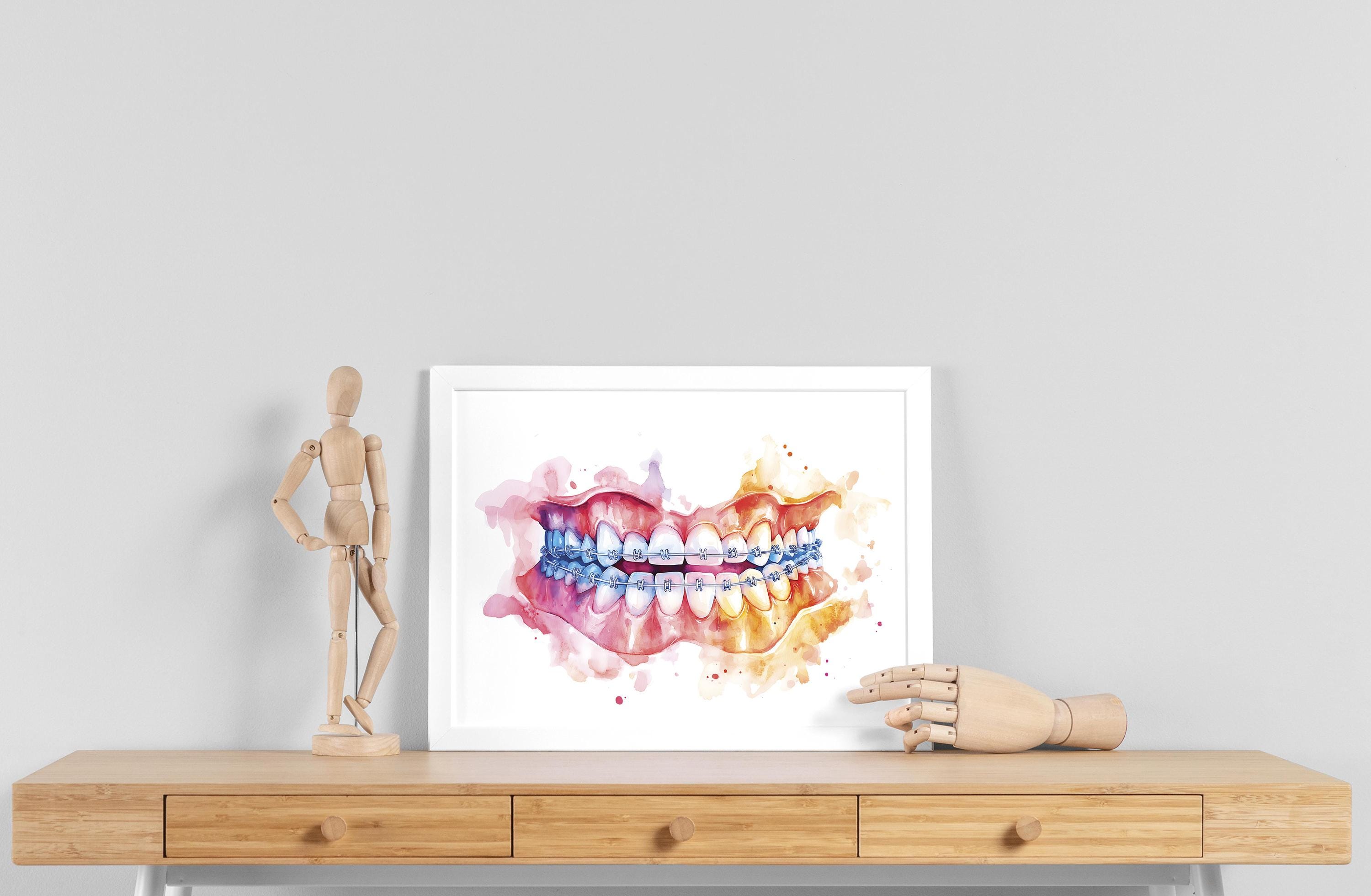 Braces Smile Watercolor Print, Orthodontist Gift, Bracket Wire ...