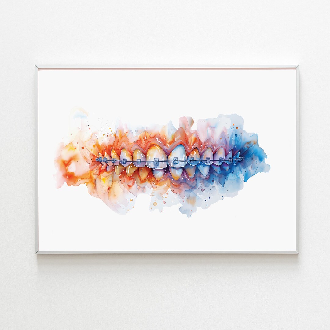 Braces Watercolor Print Orthodontic Wall Art Dental Office Decor Teeth ...