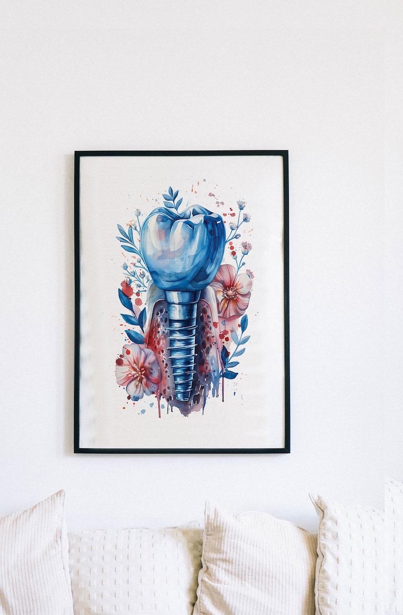 Tooth Implant Art Print Watercolor Dental Wall Art Dentist Office Decor ...