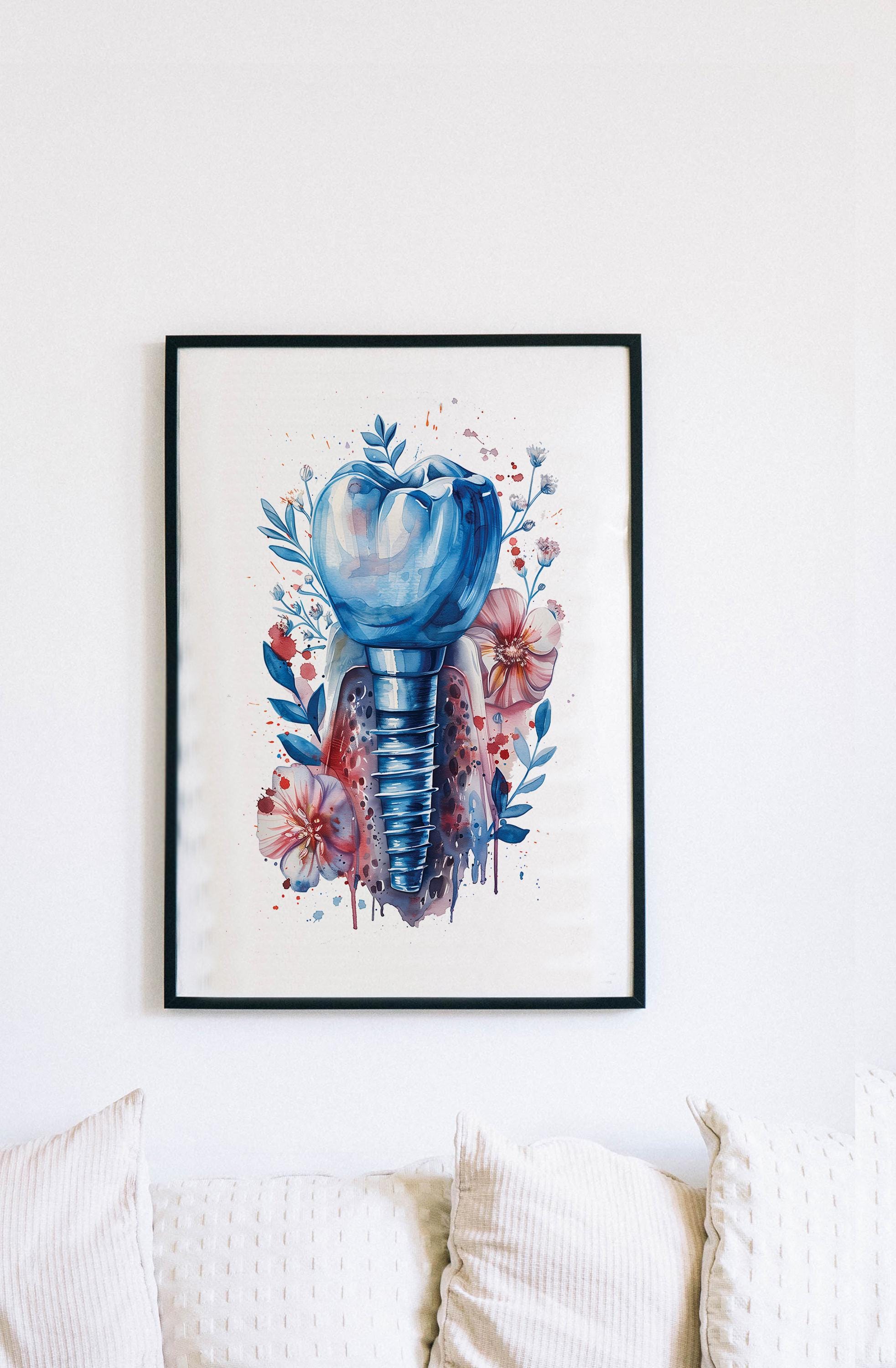 Tooth Implant Art Print Watercolor Dental Wall Art Dentist Office Decor ...