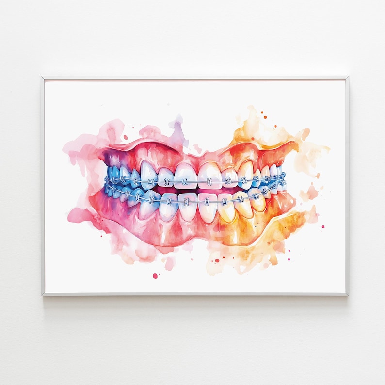 Braces Smile Watercolor Print, Orthodontist Gift, Bracket Wire ...