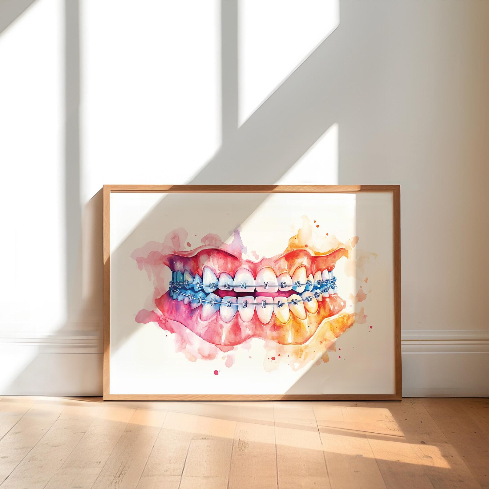 Braces Smile Watercolor Print, Orthodontist Gift, Bracket Wire ...