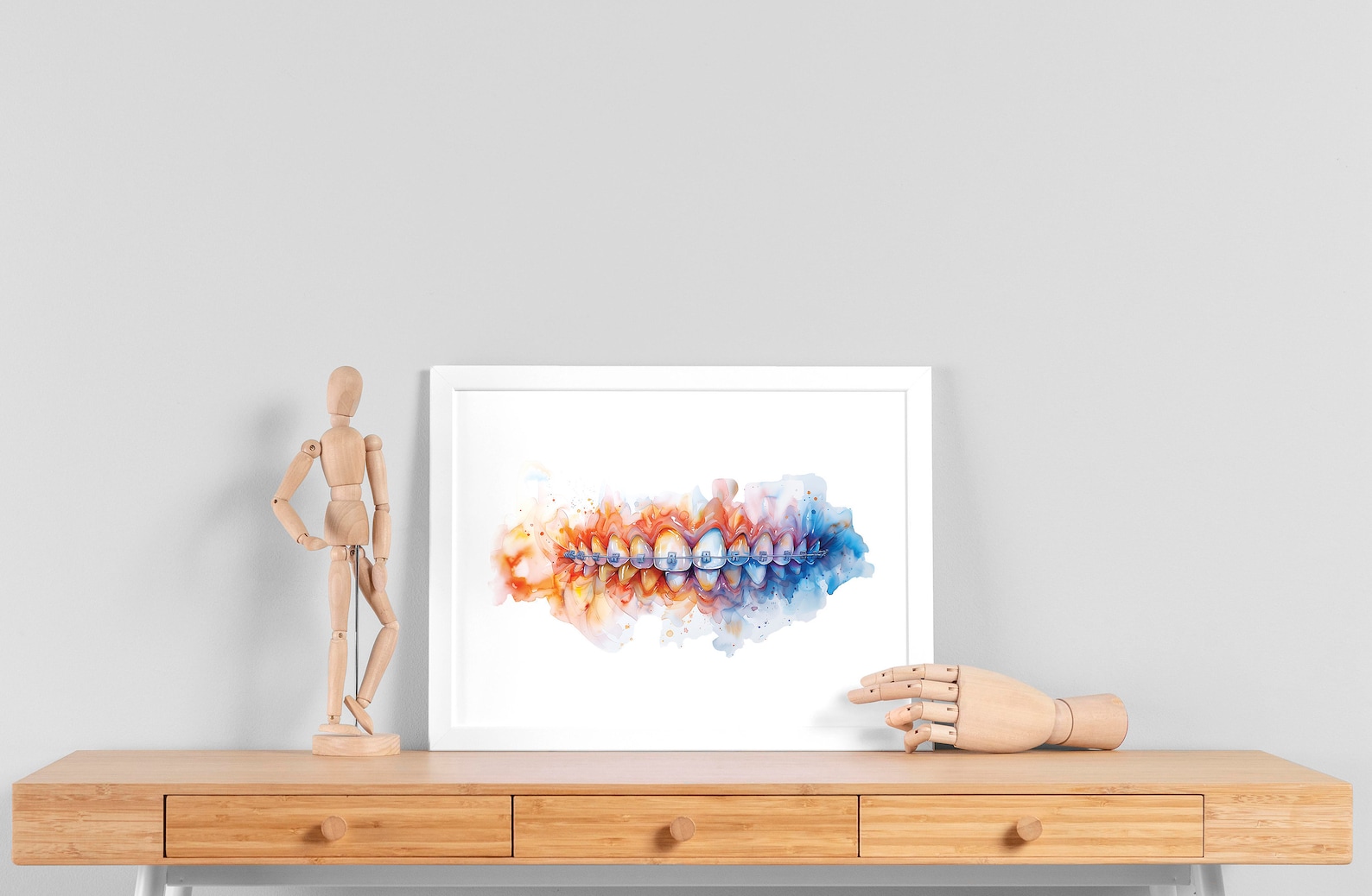 Braces Watercolor Print Orthodontic Wall Art Dental Office Decor Teeth ...