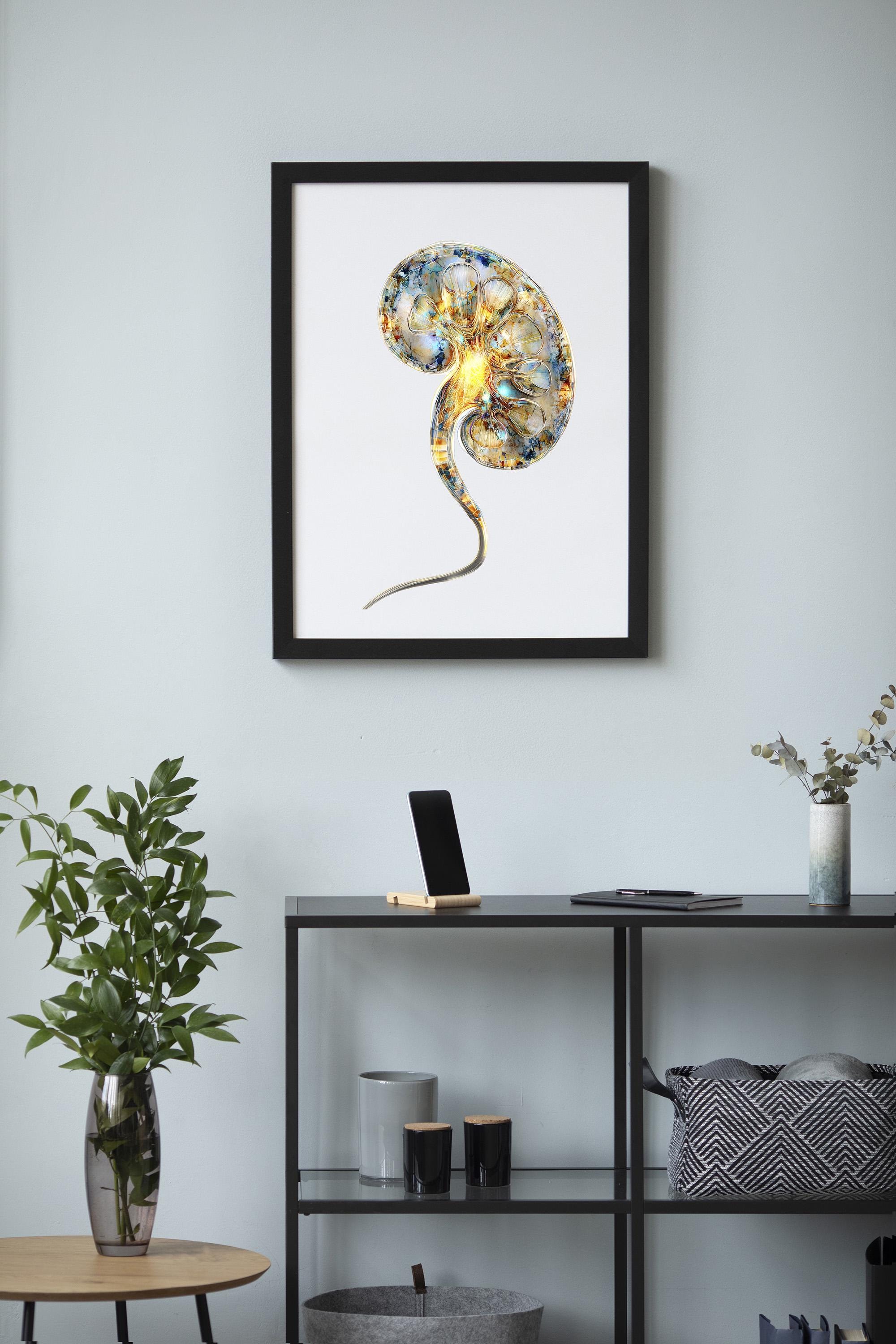 Gold Kidneys Art Print, Nephroart Printable, Medical Anatomy Wall Decor ...