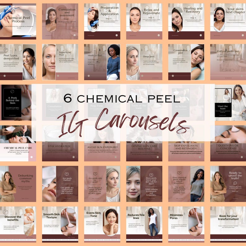 Chemical Peel Instagram Canva Carousels | Esthetician Social Media ...