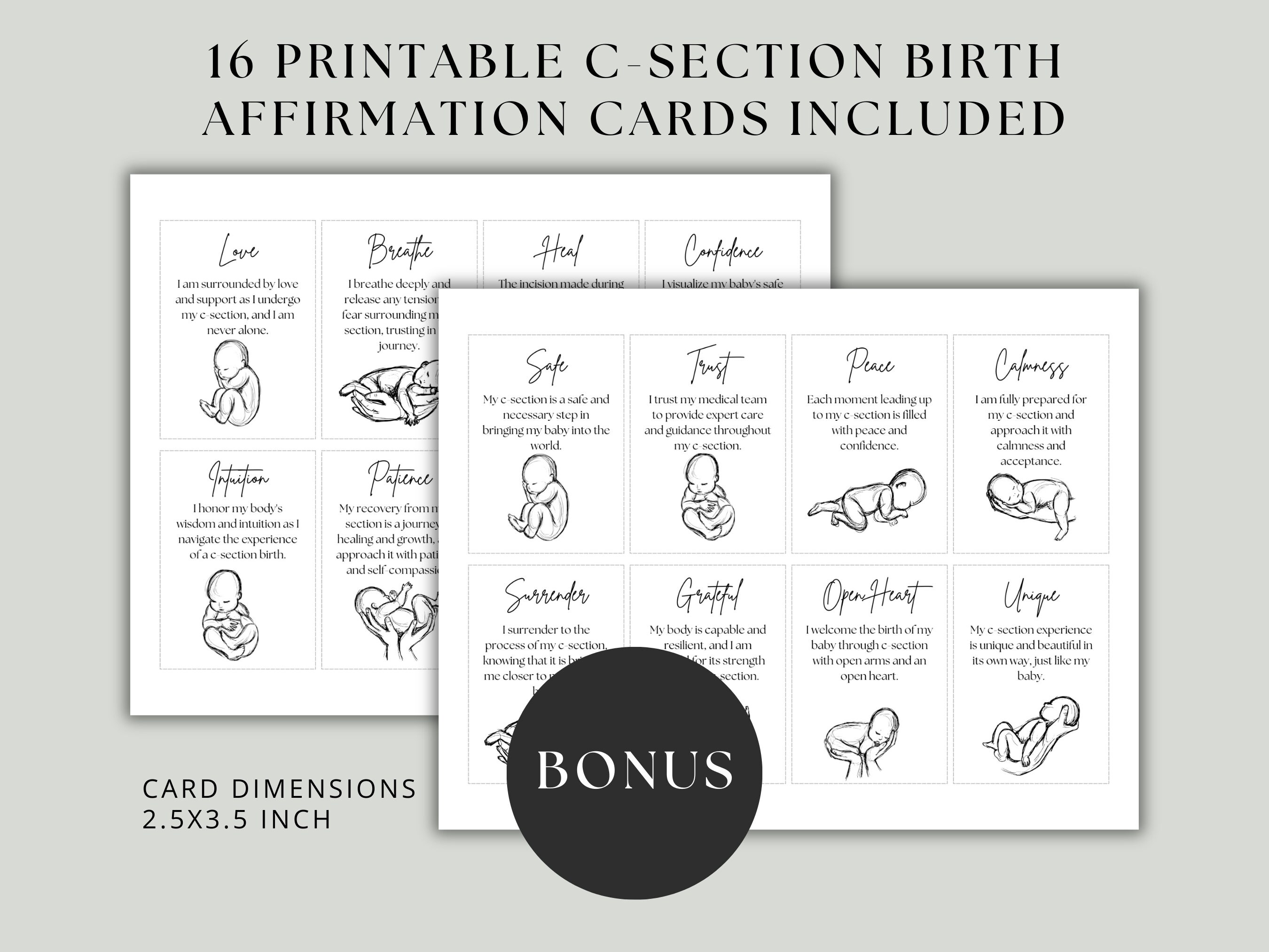 C-section Birth Plan Template, Cesarean Birth Plan, Gentle C-section ...