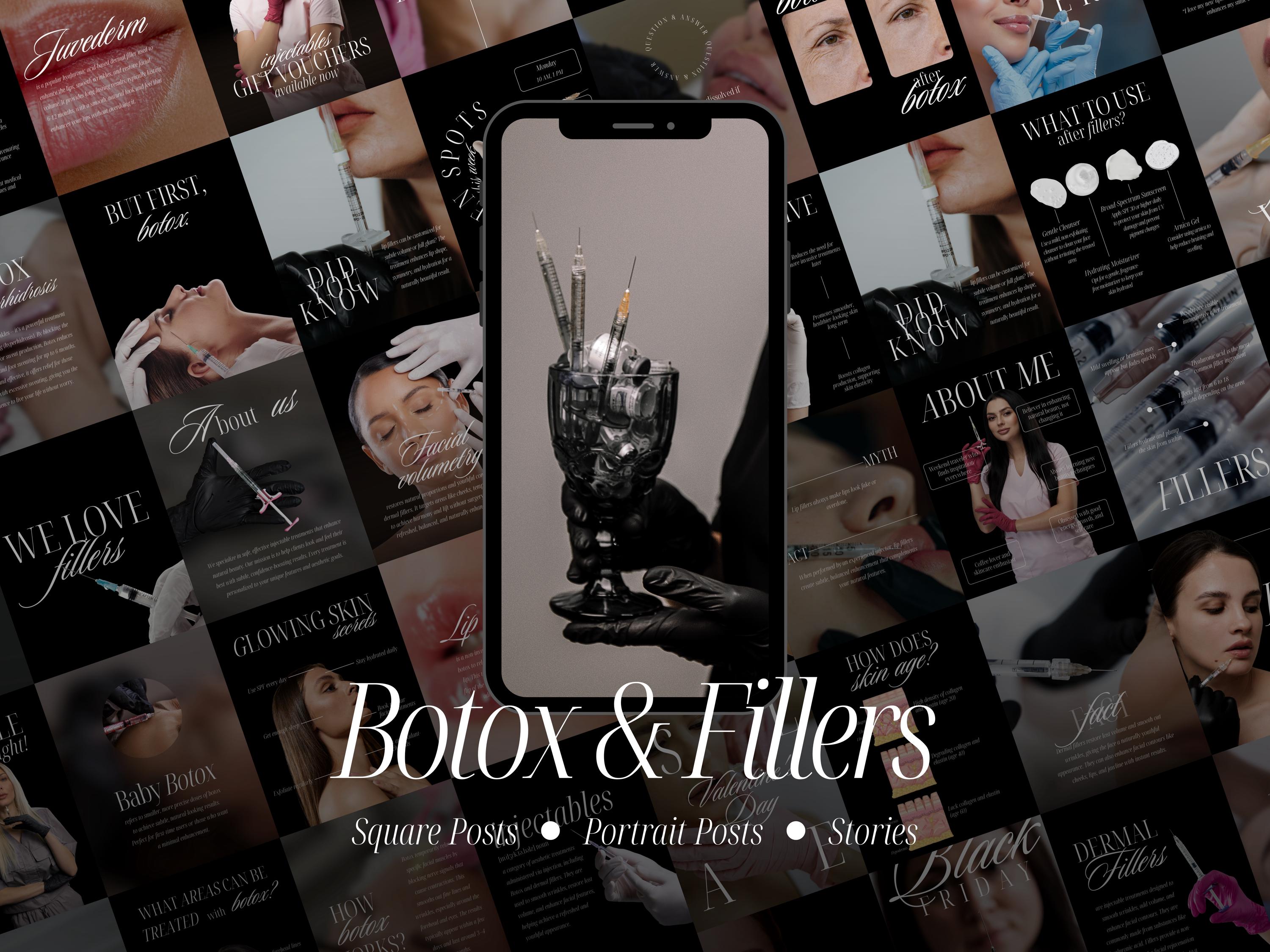 Botox and Fillers Instagram Templates, Canva Designs (digital Download ...