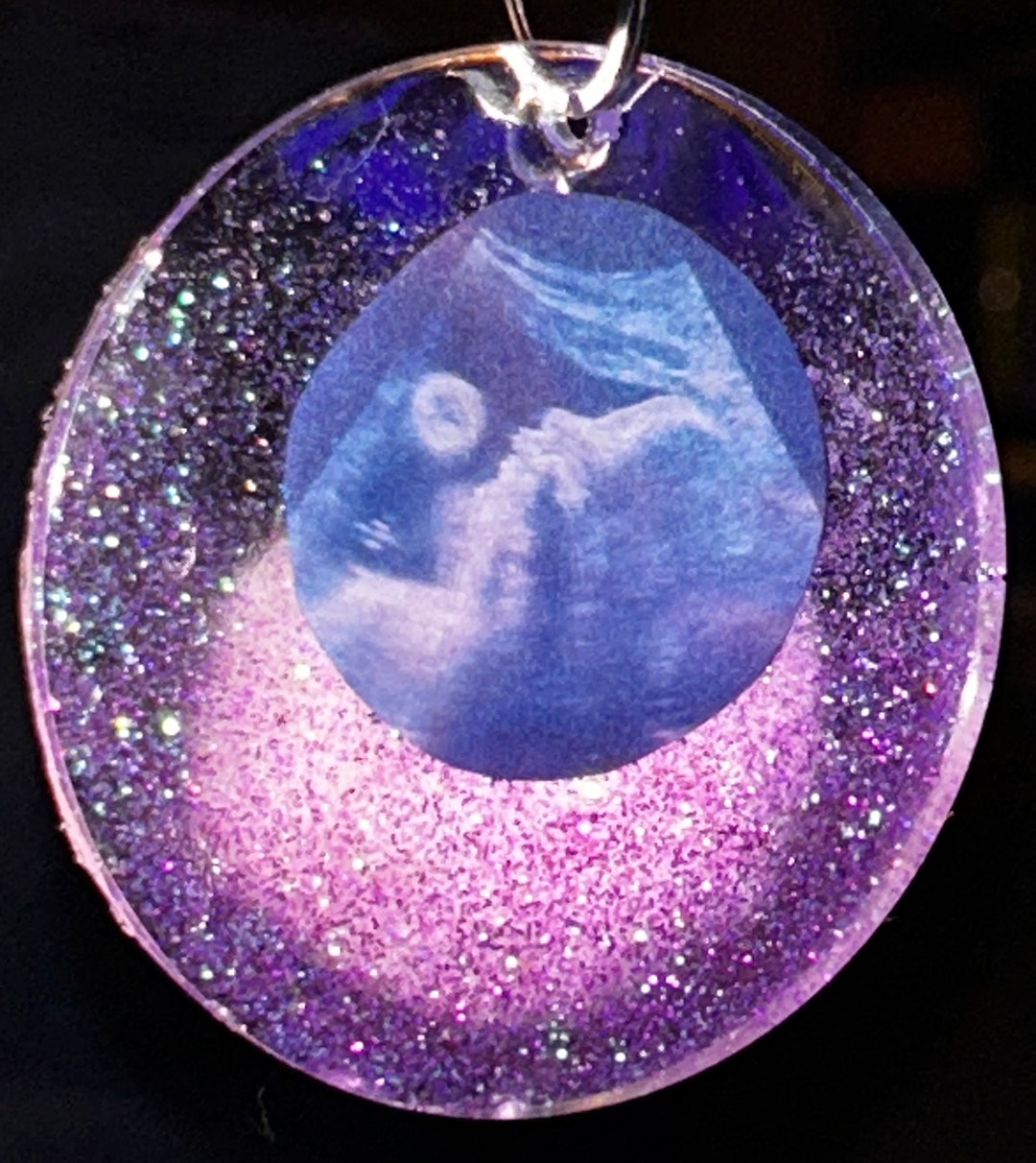 Ultrasound Keychain - Etsy