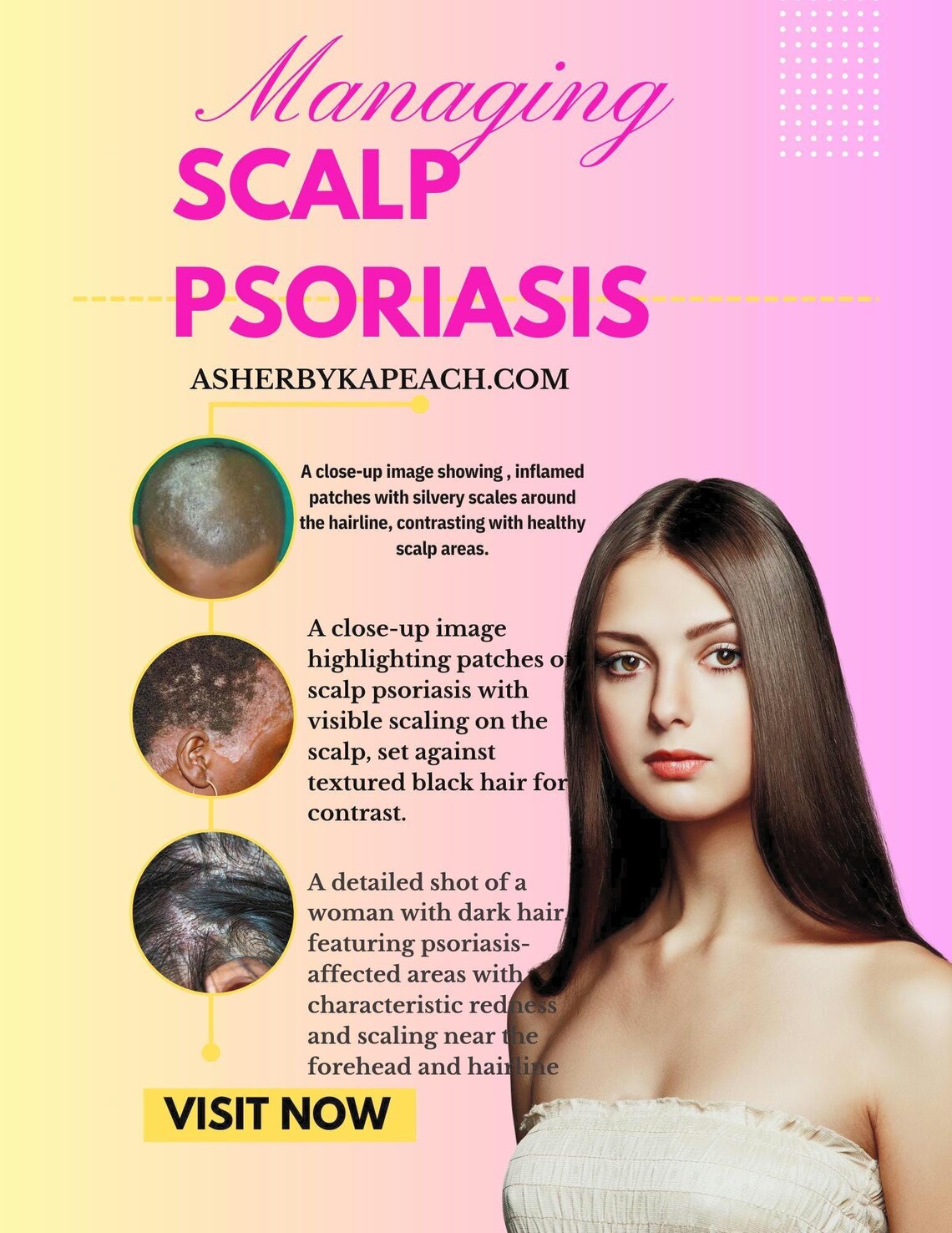 Managing Scalp Psoriasis Etsy