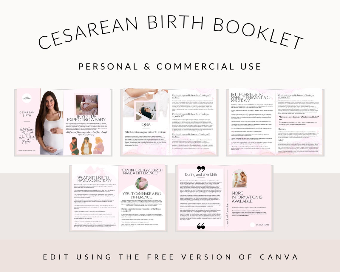 Cesarean Birth Information Booklet, Doula Handouts, C Section Birth ...