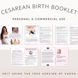 Cesarean Birth Information Booklet: Doula Handouts, C-section Guide ...