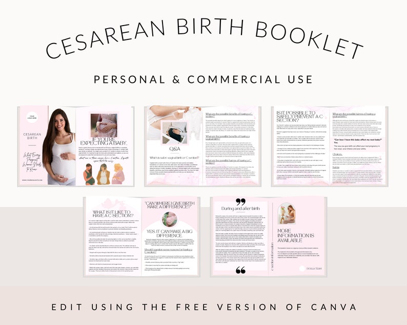 Cesarean Birth Information Booklet, Doula Handouts, C Section Birth ...