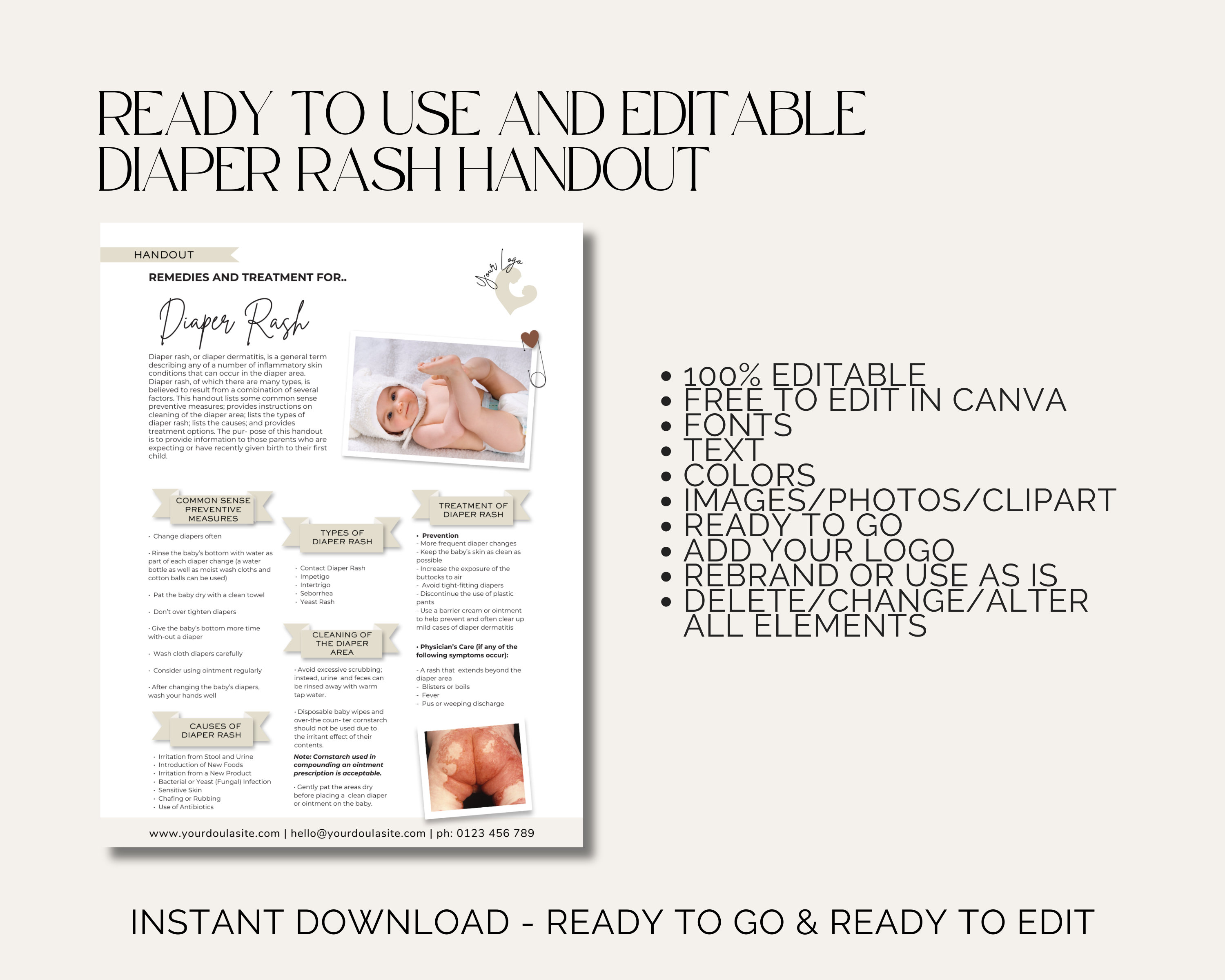 Diaper Rash Handout, Postpartum Handout Template, Doula Handouts ...