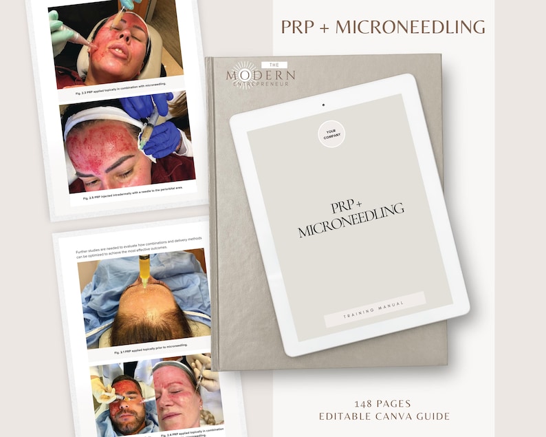 Platelet Rich Plasma PRP & Microneedling Training Manual: Editable ...