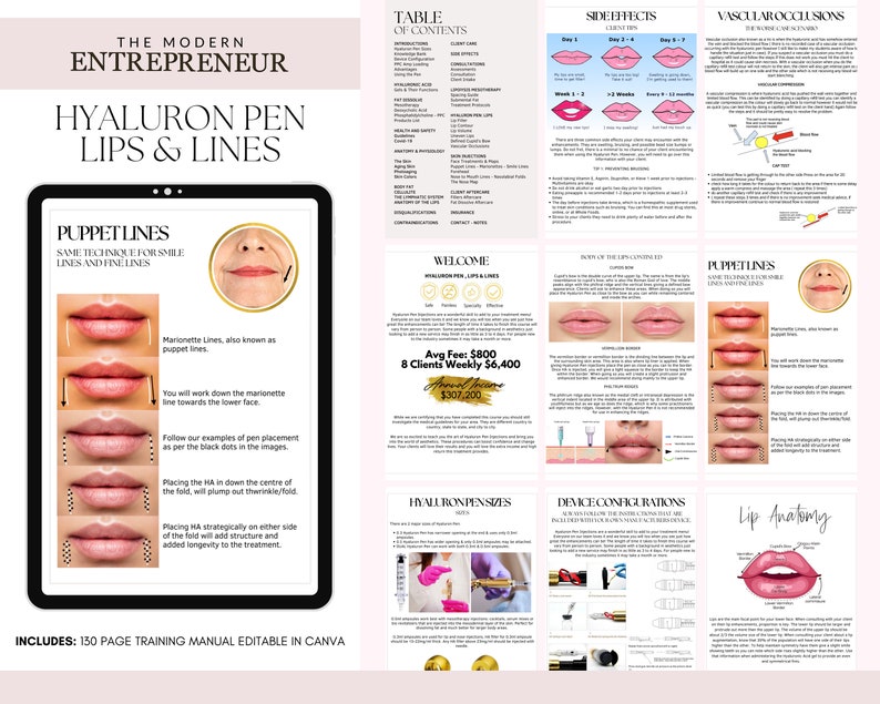 Hyaluron Pen Lip Filler Training Manual: Editable Canva Template - Etsy