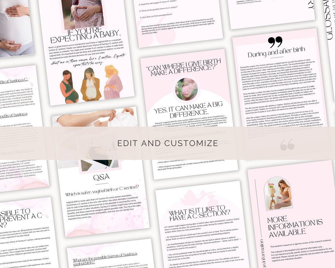 Cesarean Birth Information Booklet, Doula Handouts, C Section Birth ...