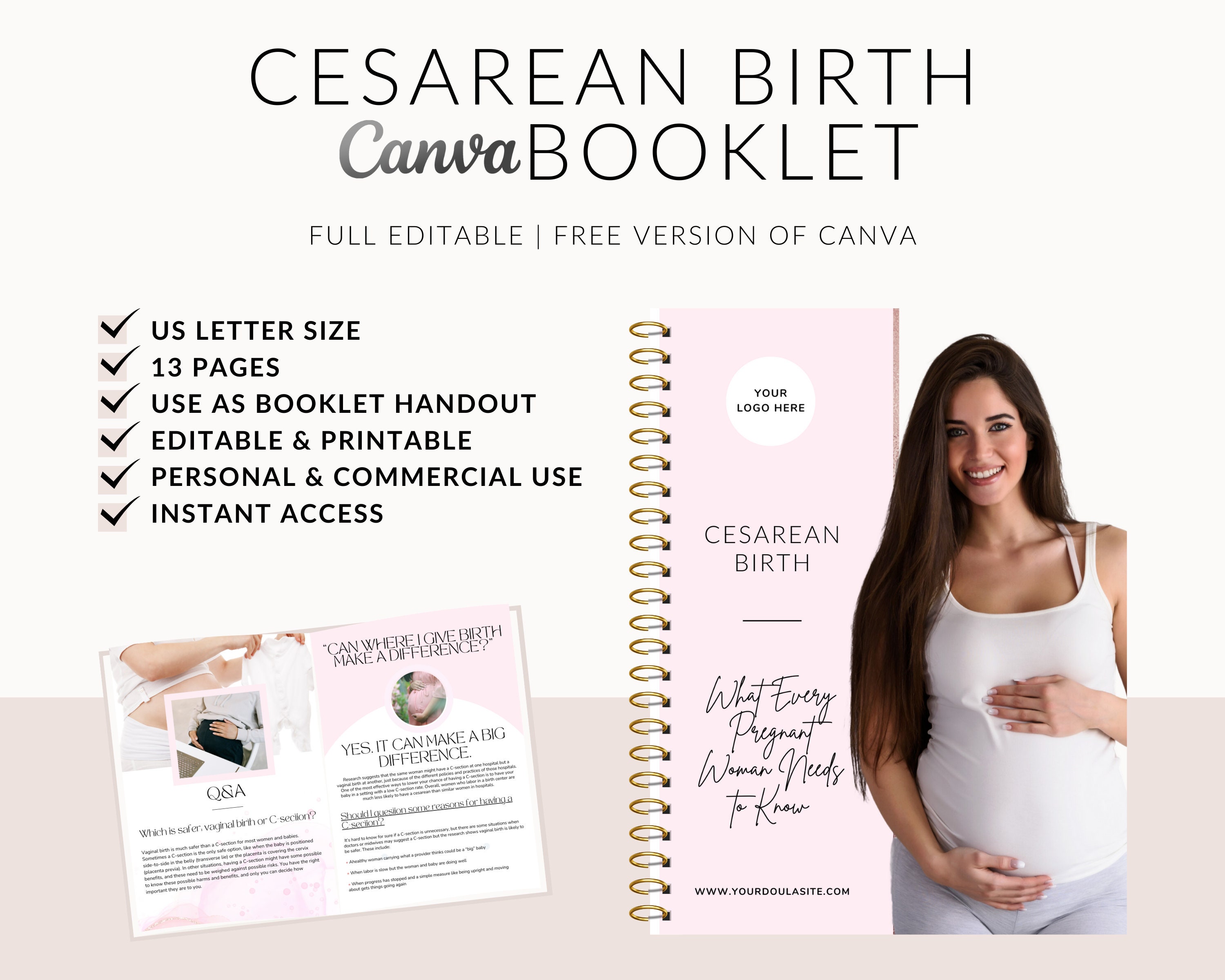 Cesarean Birth Information Booklet, Doula Handouts, C Section Birth ...