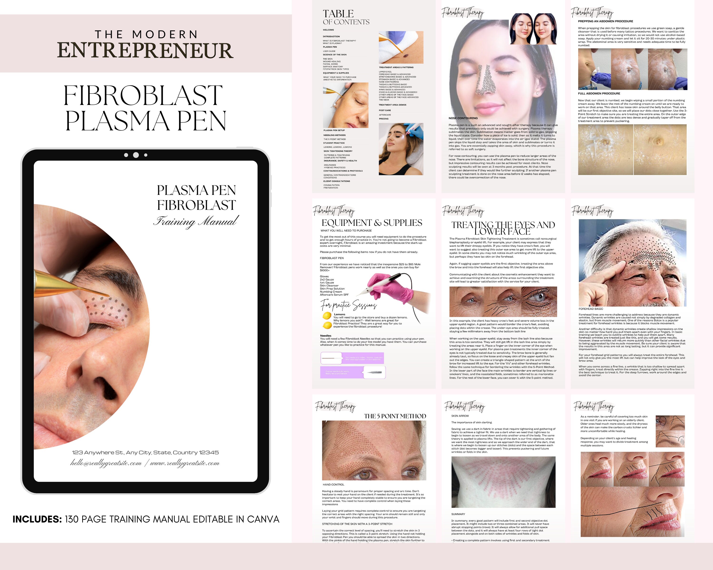 Plasma Pen Training Manual, Fibroblast Training Guide, Advanced ...