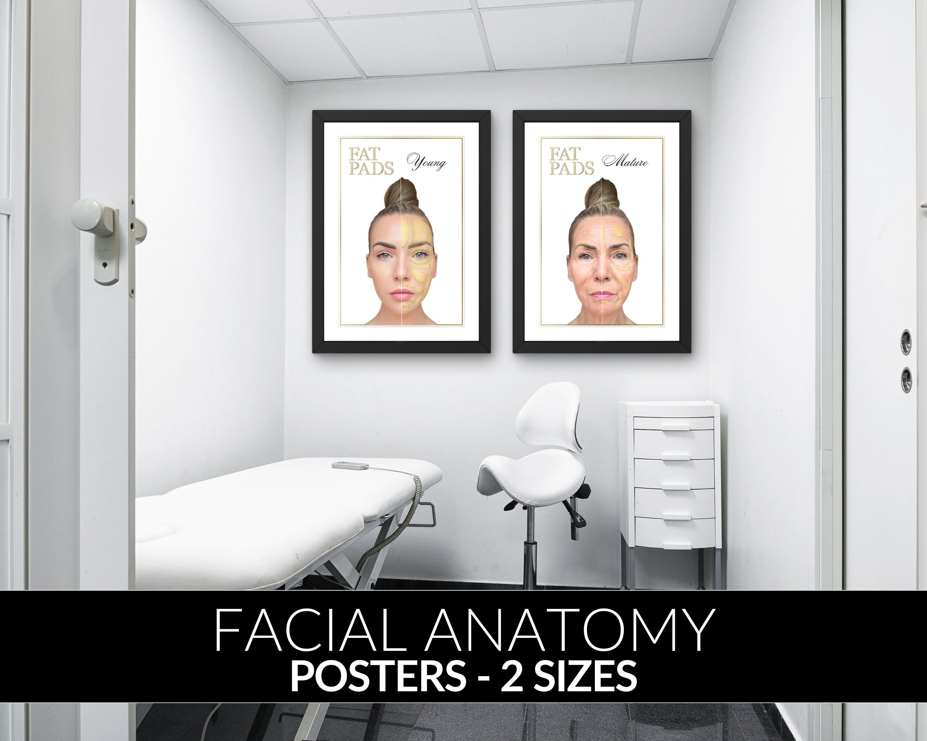 Facial Anatomy Posters, Facial Fat Pads, Aesthetic Clinic Posters ...
