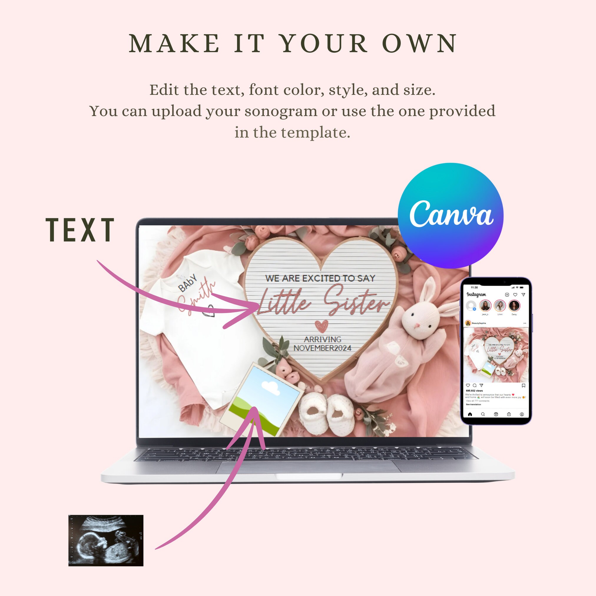 Girl Pregnancy Announcement Digital Baby Announcement Girl Gender ...