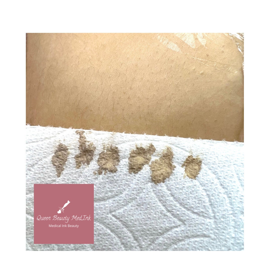 PMU Color Theory for Stretch Marks and Scars Advanced - Etsy